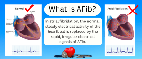 A Comprehensive Guide to Managing Atrial Fibrillation (Mastering the ...